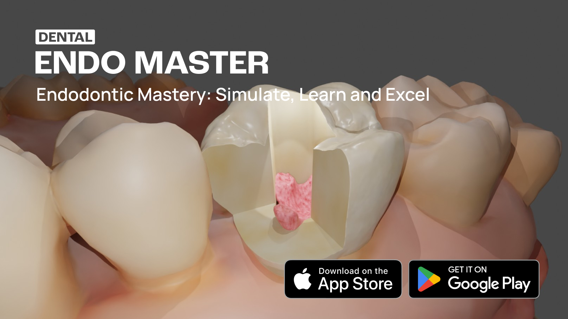 Download Now! - Dental Master Series
