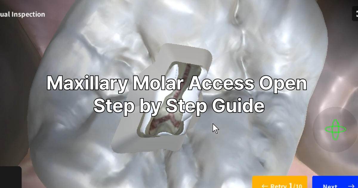 Maxillary Molar Access Open:Step by Step Guide - Dental Master Series
