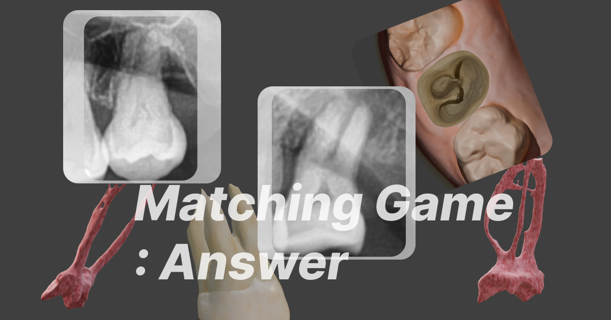 Matching Game: Answers Revealed! - Dental Master Series
