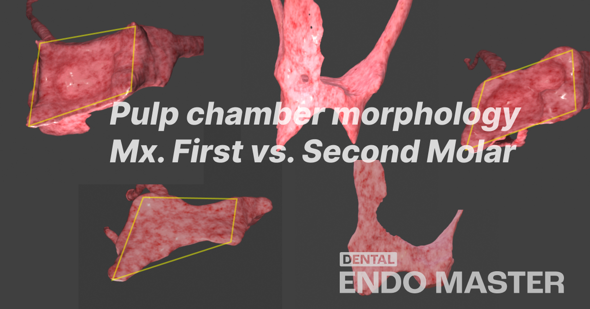 Pulp Chamber Morphology of Maxillary First and Second Molars - Dental Master Series